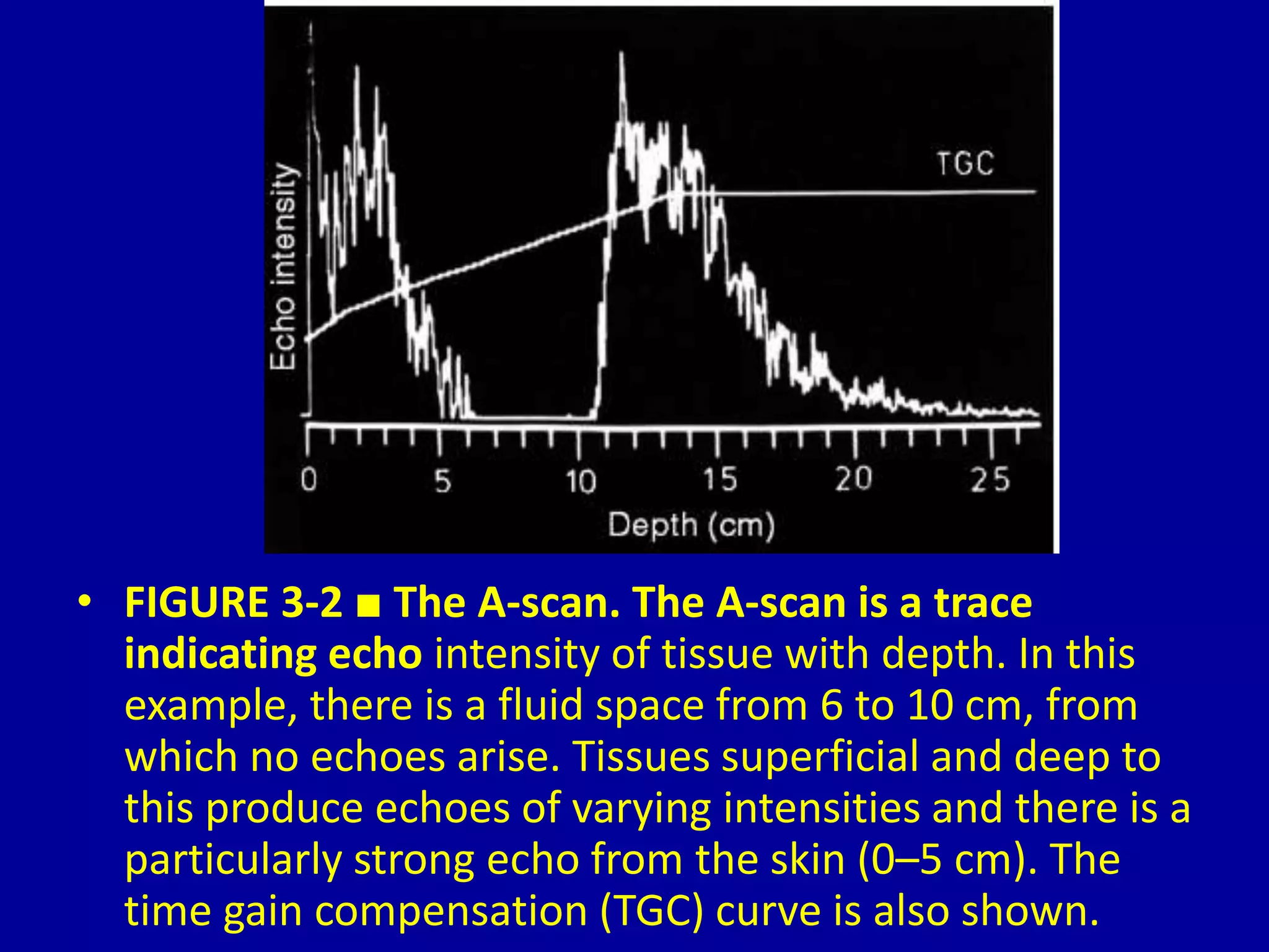 3 ultrasound Ultrasound Physics Garringer and Aliison Dr. Muhammad Bin ...