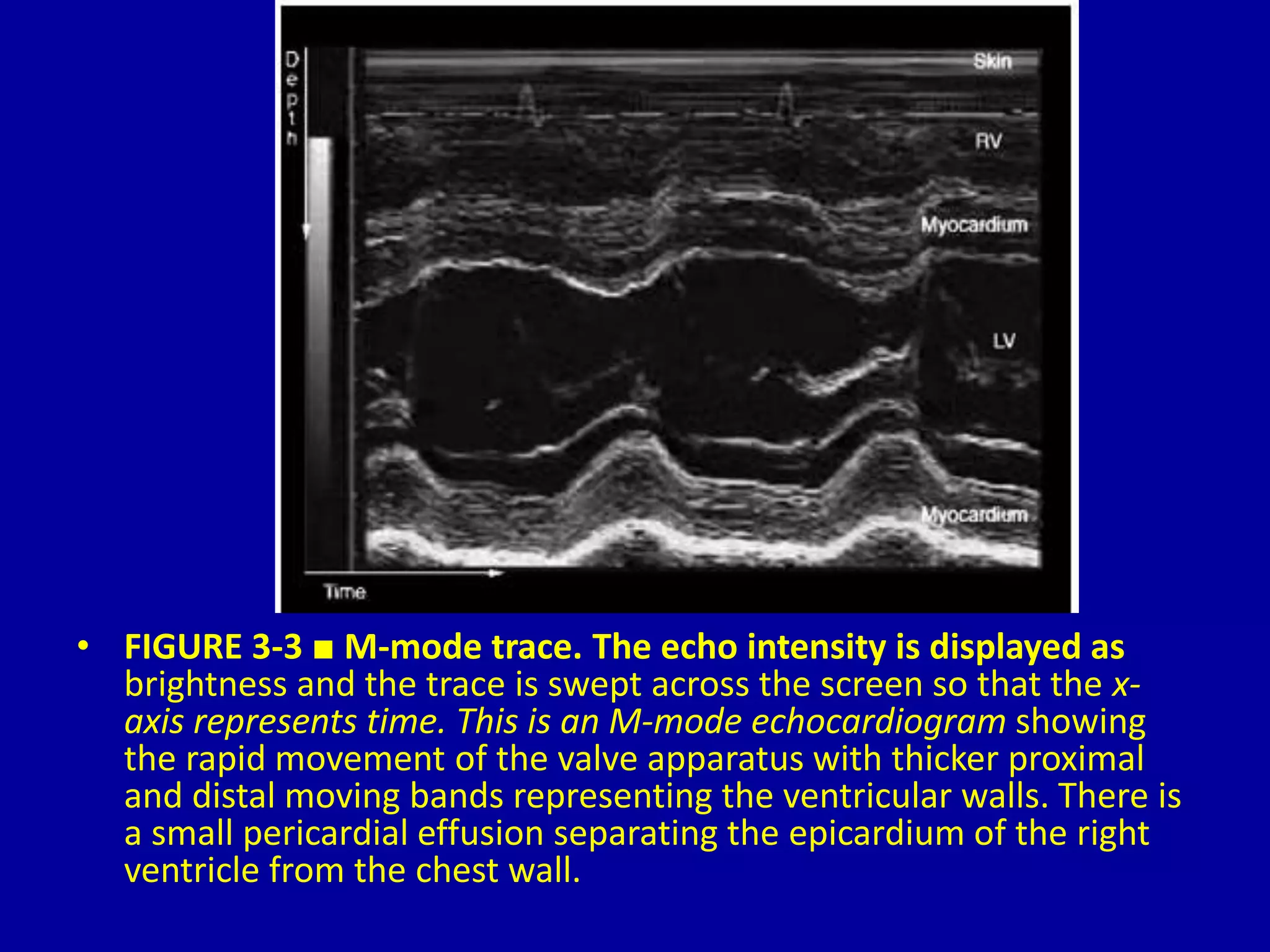 3 ultrasound Ultrasound Physics Garringer and Aliison Dr. Muhammad Bin Zulfiqar | PPTX