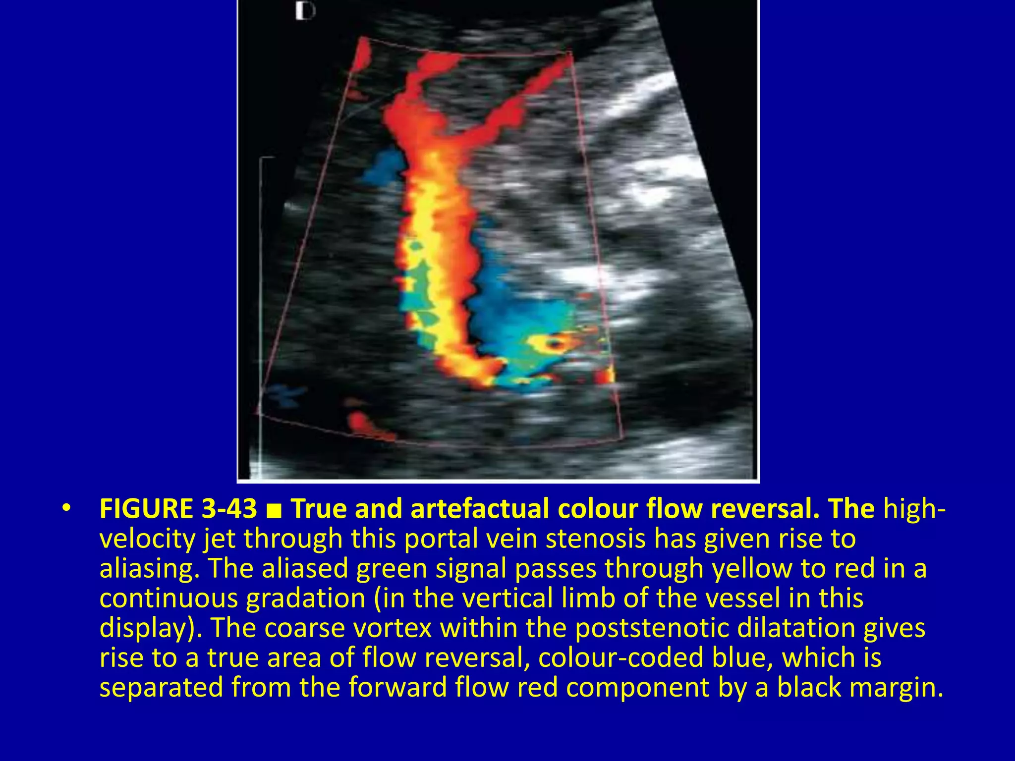 3 ultrasound Ultrasound Physics Garringer and Aliison Dr. Muhammad Bin ...