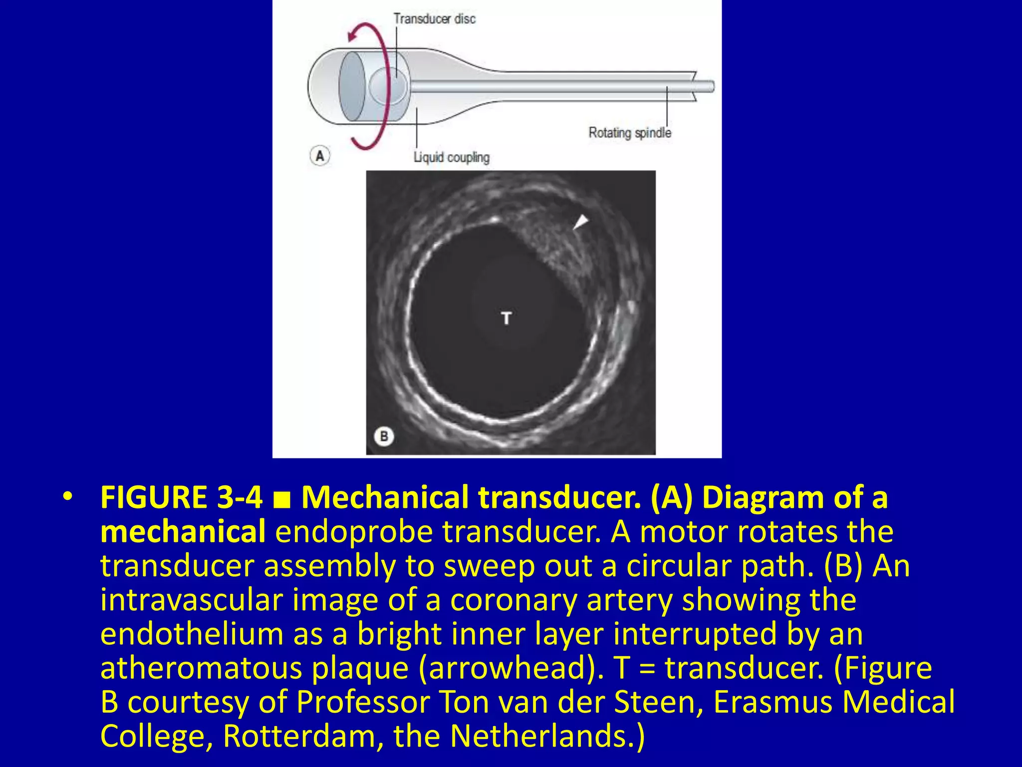 3 ultrasound Ultrasound Physics Garringer and Aliison Dr. Muhammad Bin ...