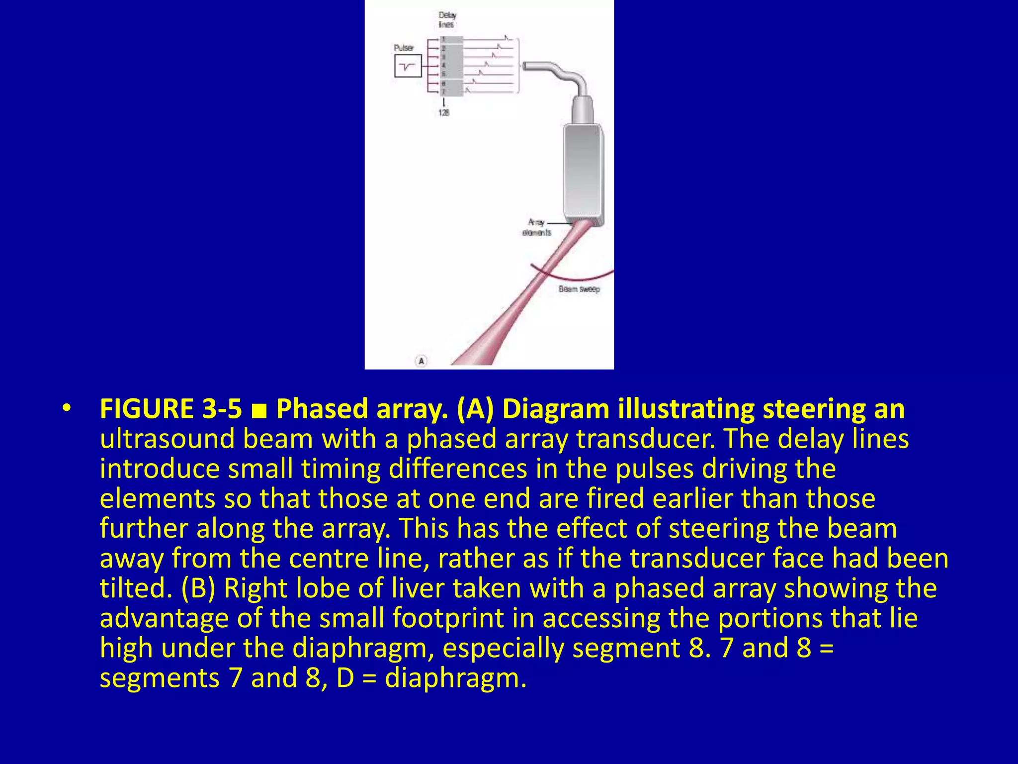 3 ultrasound Ultrasound Physics Garringer and Aliison Dr. Muhammad Bin ...