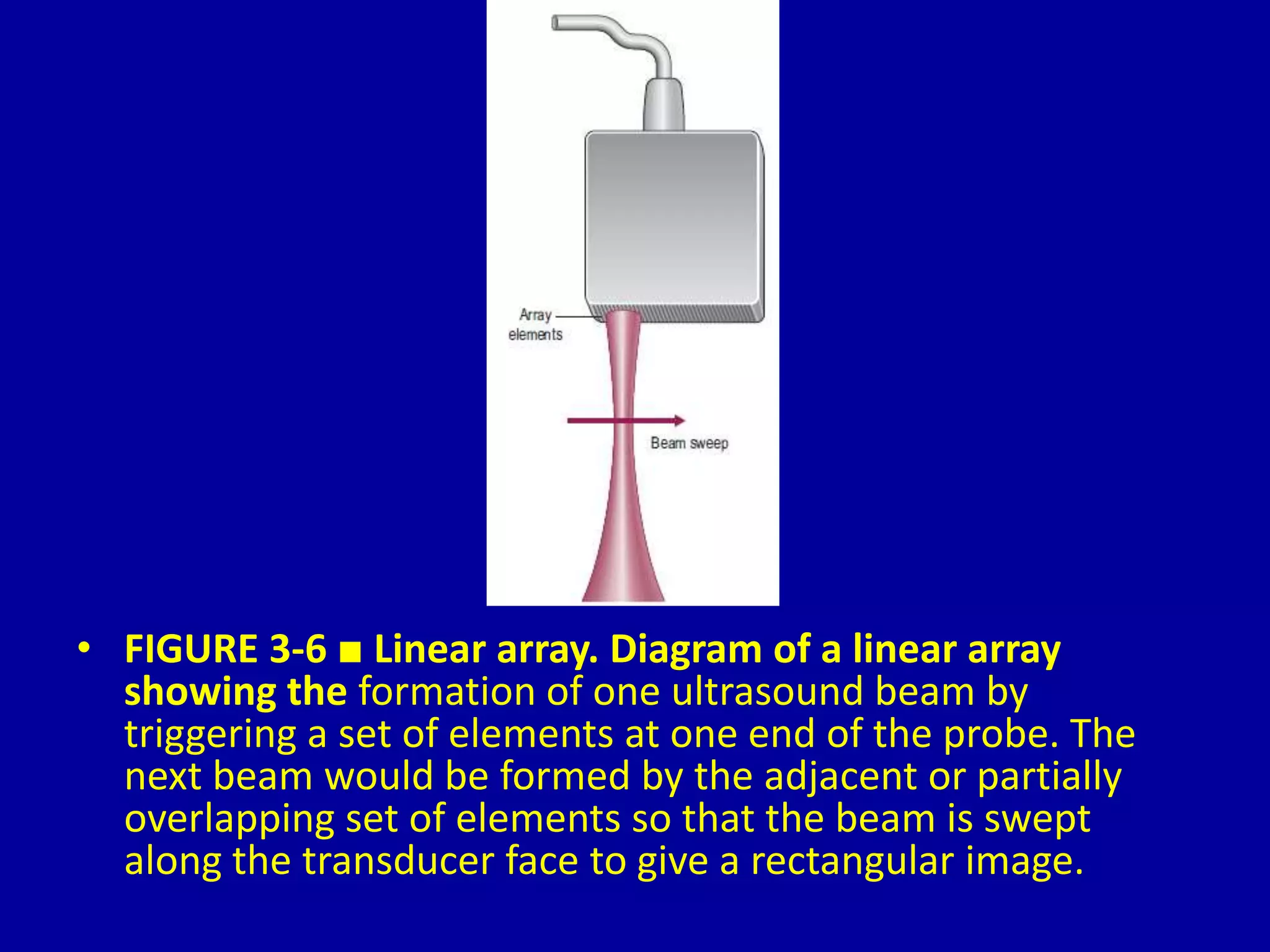 3 ultrasound Ultrasound Physics Garringer and Aliison Dr. Muhammad Bin ...