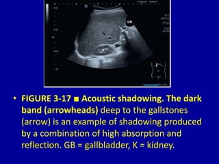 3 ultrasound Ultrasound Physics Garringer and Aliison Dr. Muhammad Bin ...