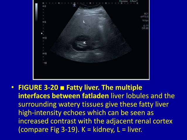 3 ultrasound Ultrasound Physics Garringer and Aliison Dr. Muhammad Bin ...