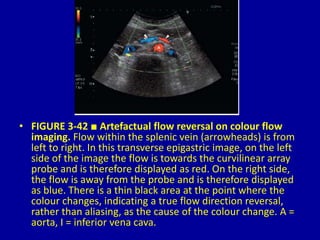3 ultrasound Ultrasound Physics Garringer and Aliison Dr. Muhammad Bin ...