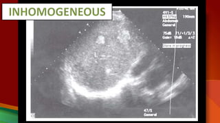 3 ultrasound nomenclature | PPTX