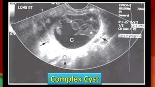 3 ultrasound nomenclature | PPTX