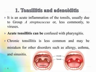 Upper respiratory disorders | PPTX