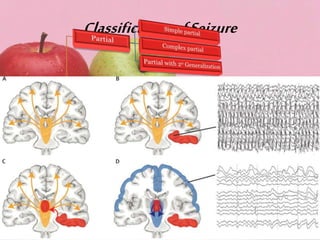Approach to patient with convulsion | PPTX