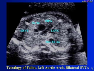 3 vessel views | PPTX