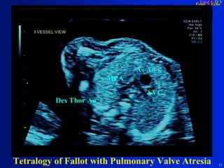 3 vessel views | PPTX