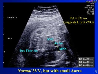 3 vessel views | PPTX