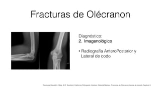 Taller bandas de tensión para fx olecranon y patela | PDF