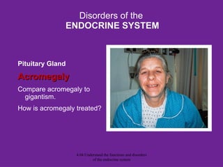 Functions and Disorders of the Endocrine System | PPT