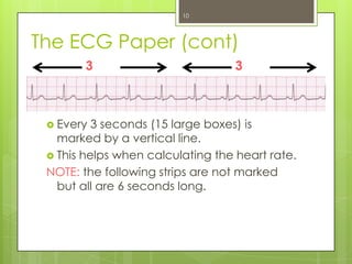 ECG | PPTX