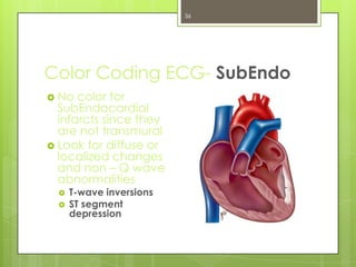 12 Lead Ecg Placement Color Coded