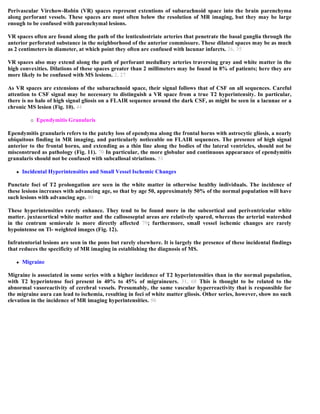 Case record... Multiple sclerosis | PDF