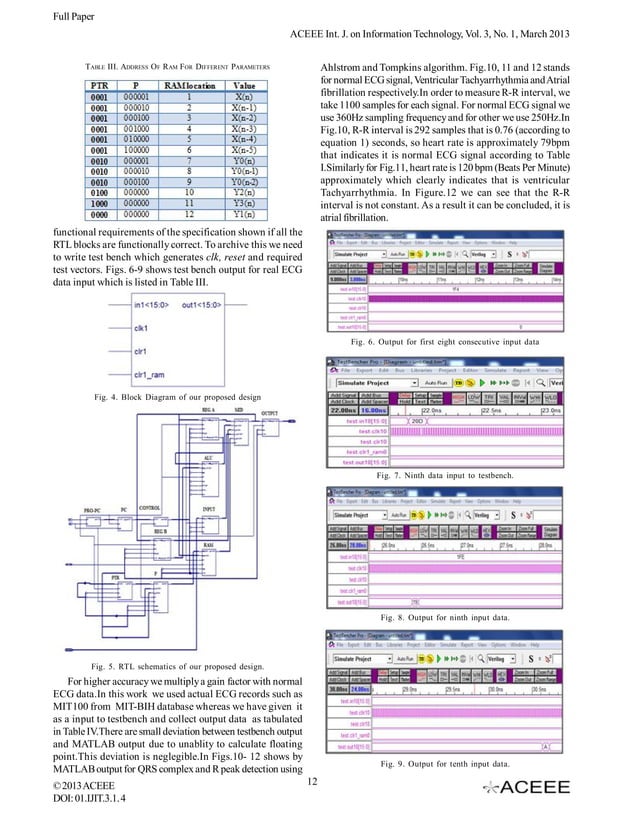 FPGA based Heart Arrhythmia’s Detection Algorithm | PDF