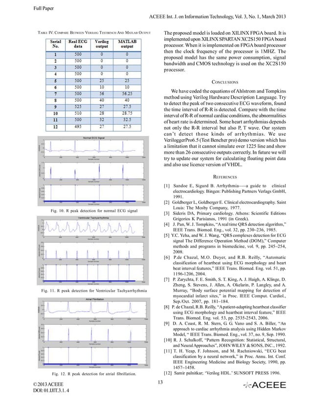 FPGA based Heart Arrhythmia’s Detection Algorithm | PDF