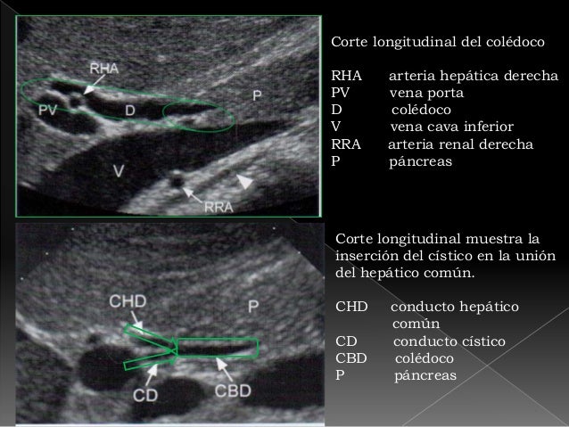 Clase de vesicula y vias biliares - Ecografia
