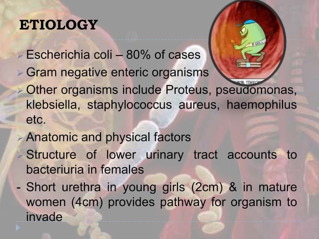 UTI in children | PPTX | Infectious Diseases | Diseases and Conditions