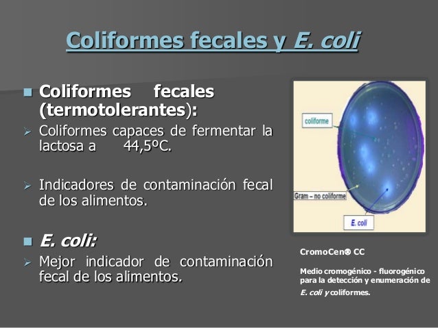 4. microorganismos indicadores