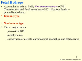 4. hydrops fetalis; pedatric pathology | PPT