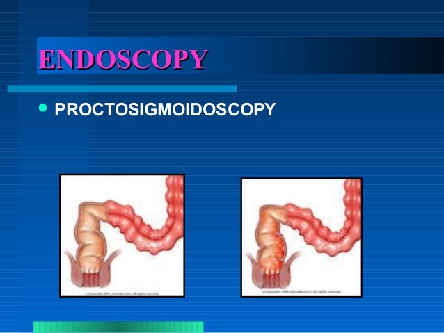 approach to a patient with Chronic diarrhoea