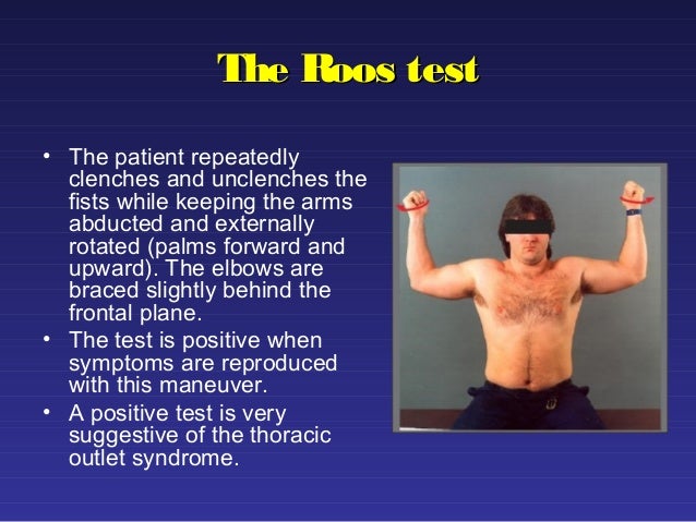 Thoracic Outlet Syndrome