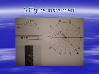 general instruments & instrumentation - Restorative Dentistry | PDF