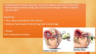 4. endometritis & metritis | PPTX