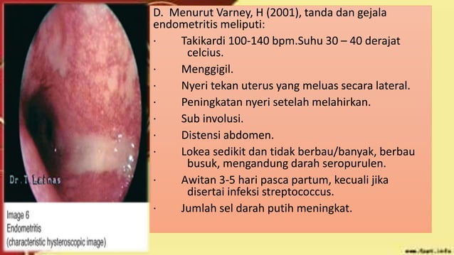 4. endometritis & metritis | PPTX