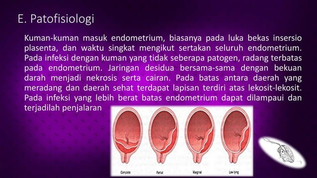 4. endometritis & metritis | PPTX