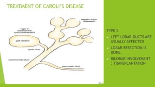 Treatment of Benign Conditions Causing Surgical Jaundice | PPTX
