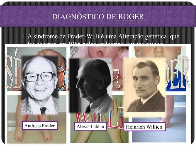 Síndrome de Prader Willi | PPT