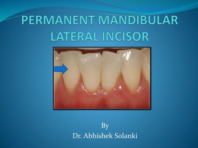 Permanent Mandibular Lateral Incisor | PPTX | Dental Health | Diseases ...