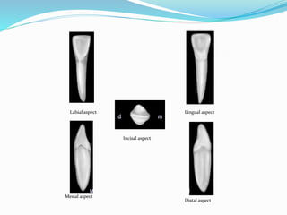 Permanent Mandibular Lateral Incisor | PPTX