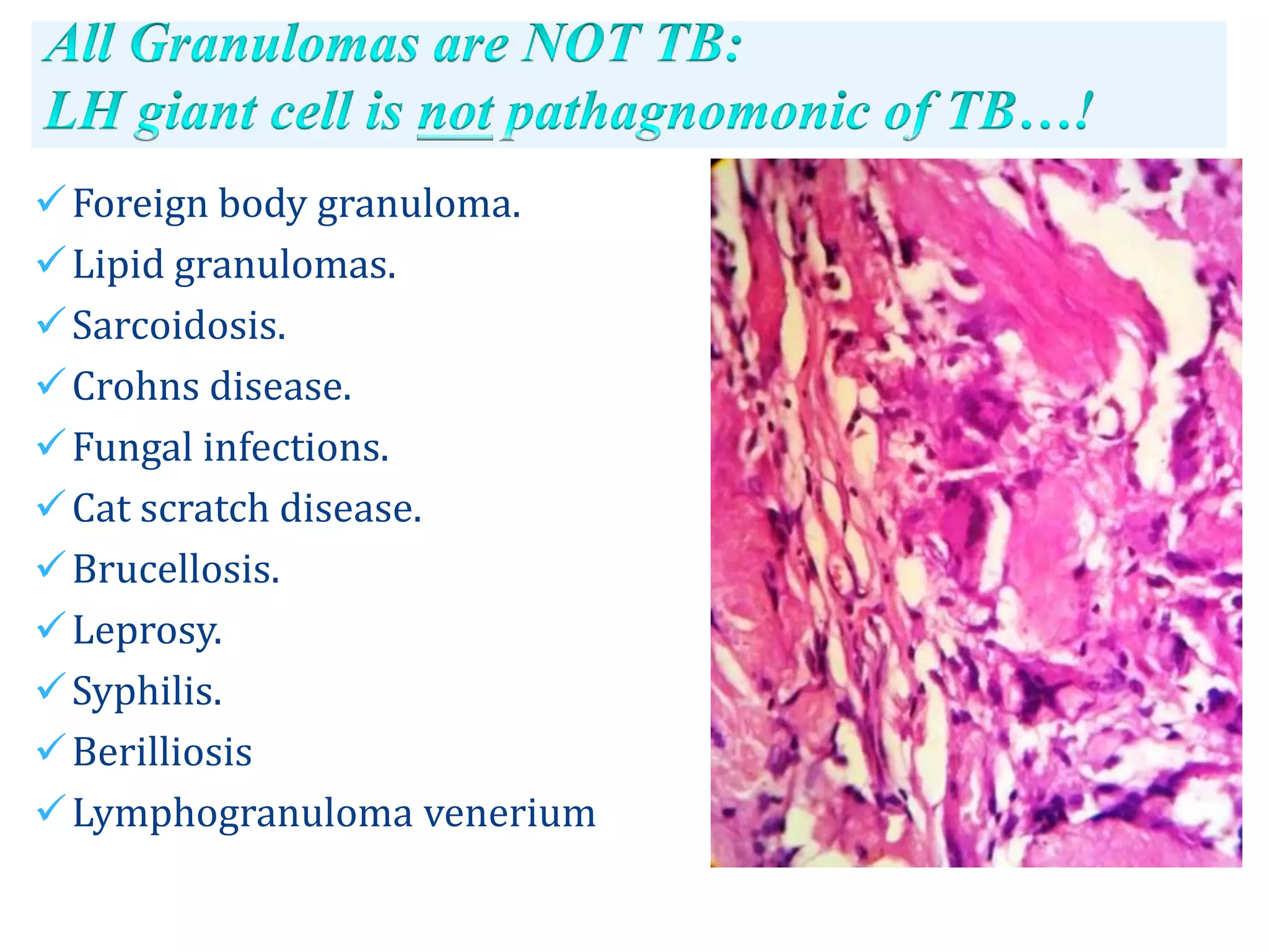 4. chronic inflammation granulomatous inflammation -dr. sinhasan- mdzah ...