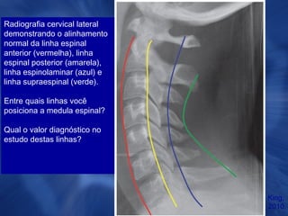 4. radiologia cervical rx do trauma | PPT