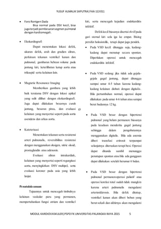 Defek Septum Ventrikel | PDF