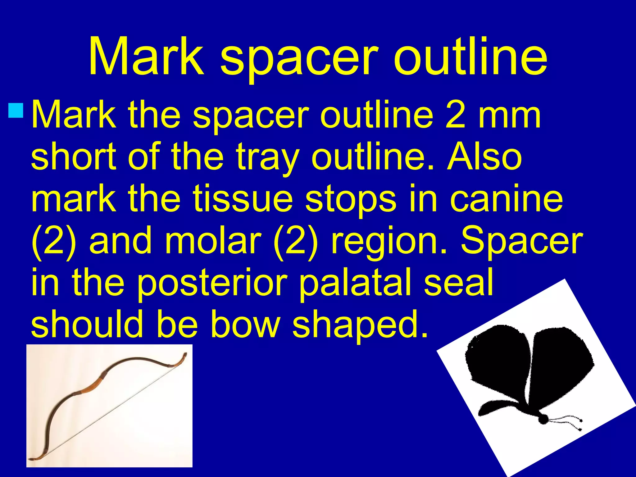 custom trays & master casts | PPT