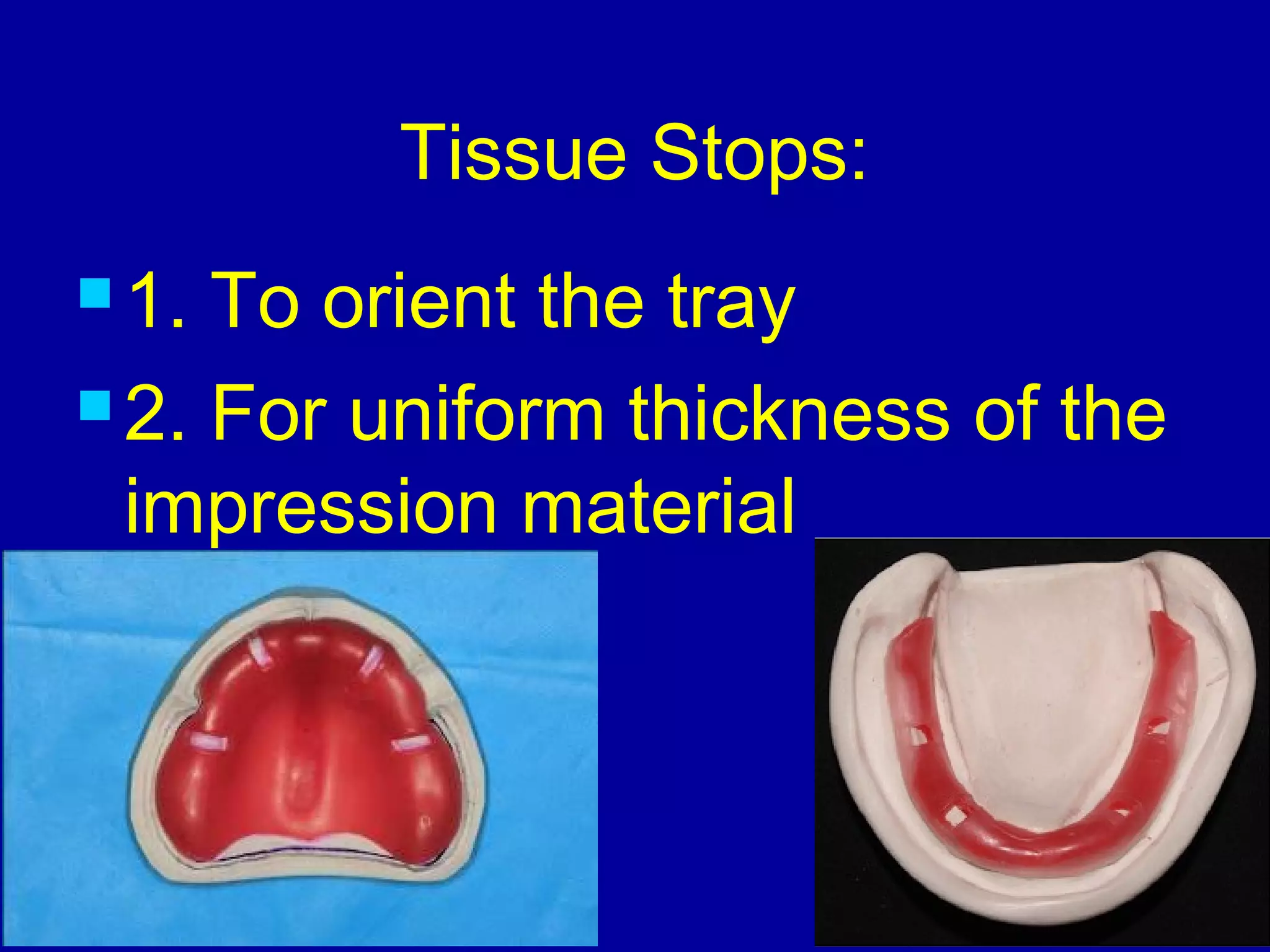 custom trays & master casts | PPT