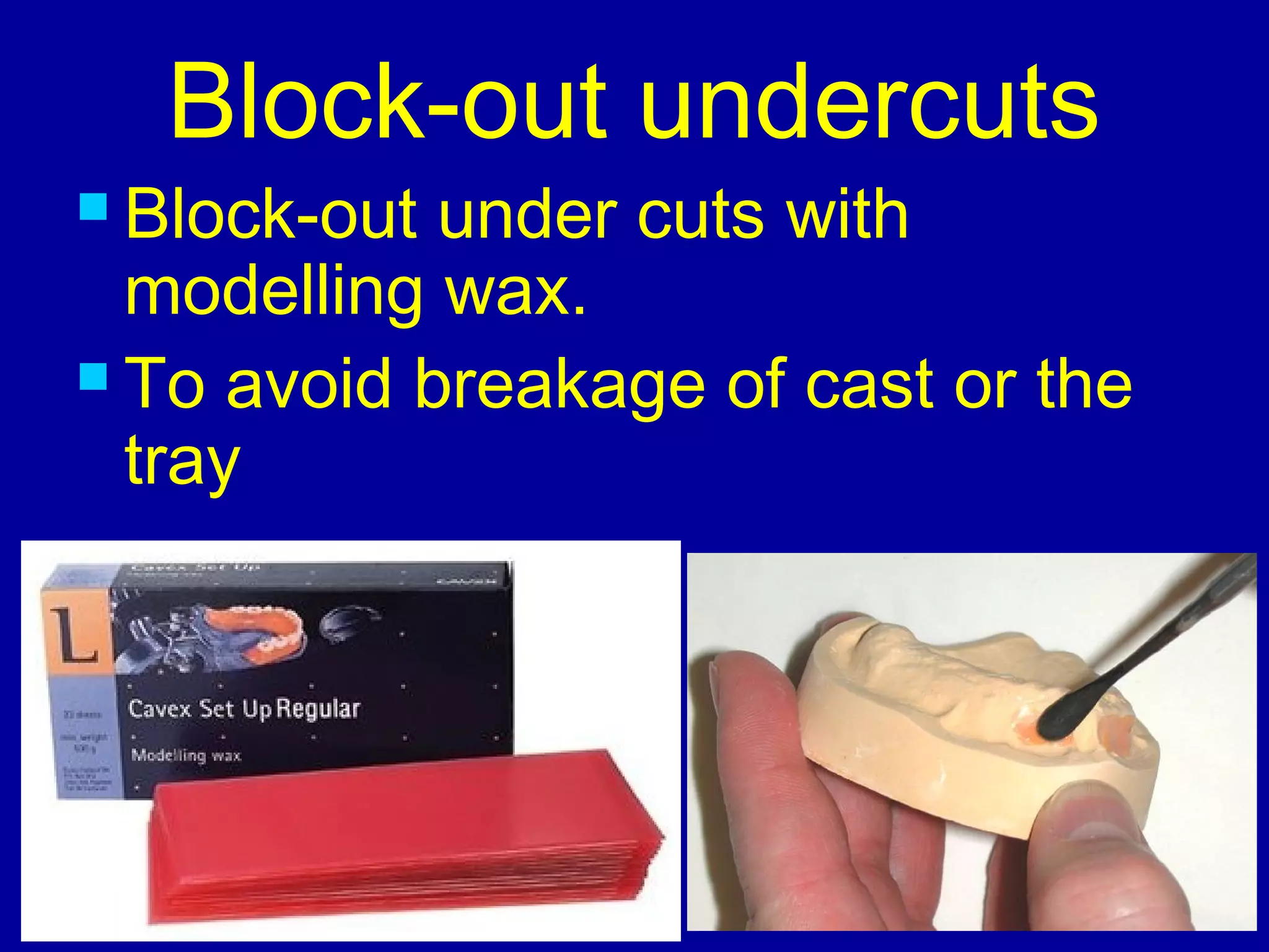 custom trays & master casts | PPT