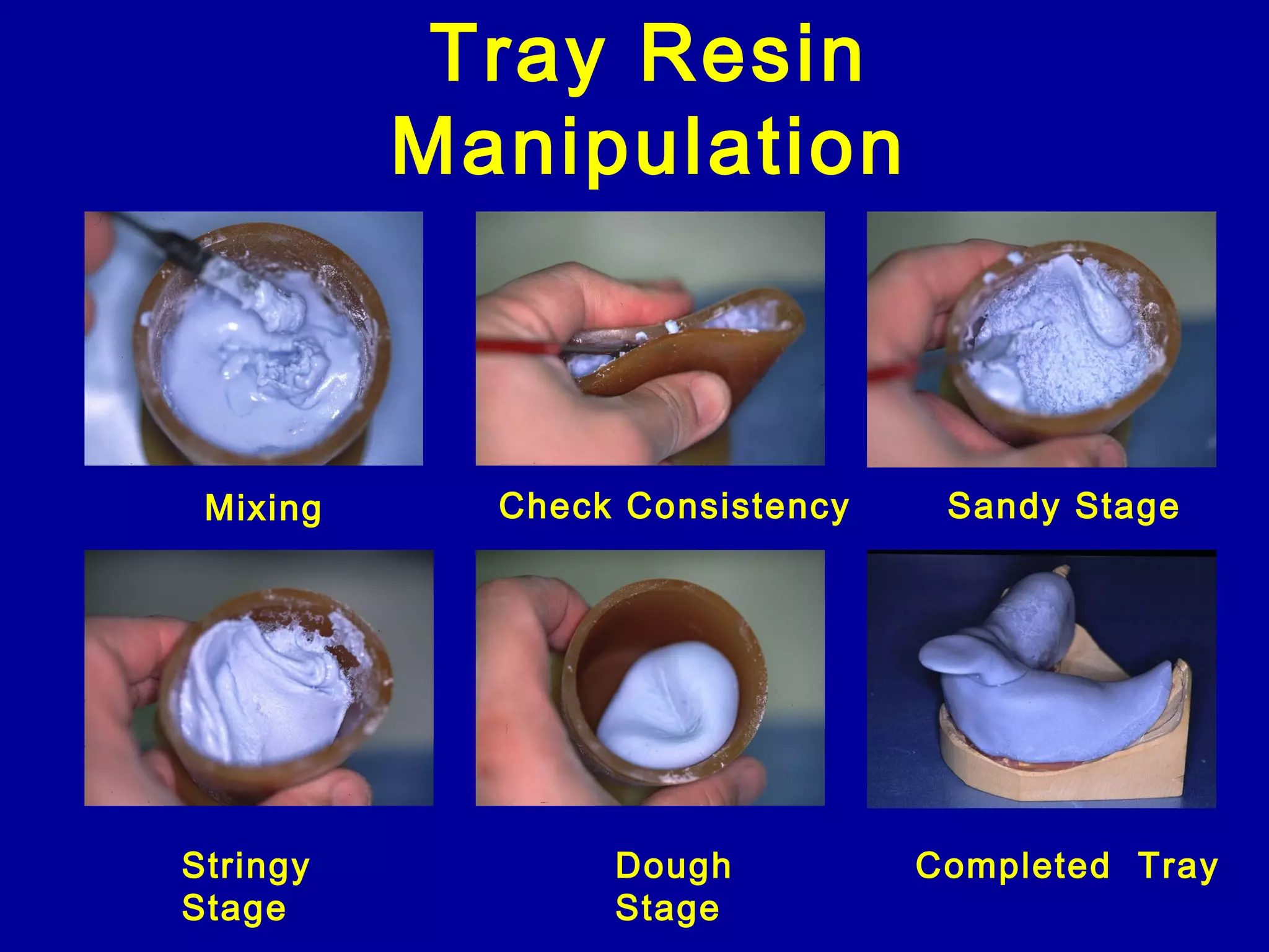 custom trays & master casts | PPT