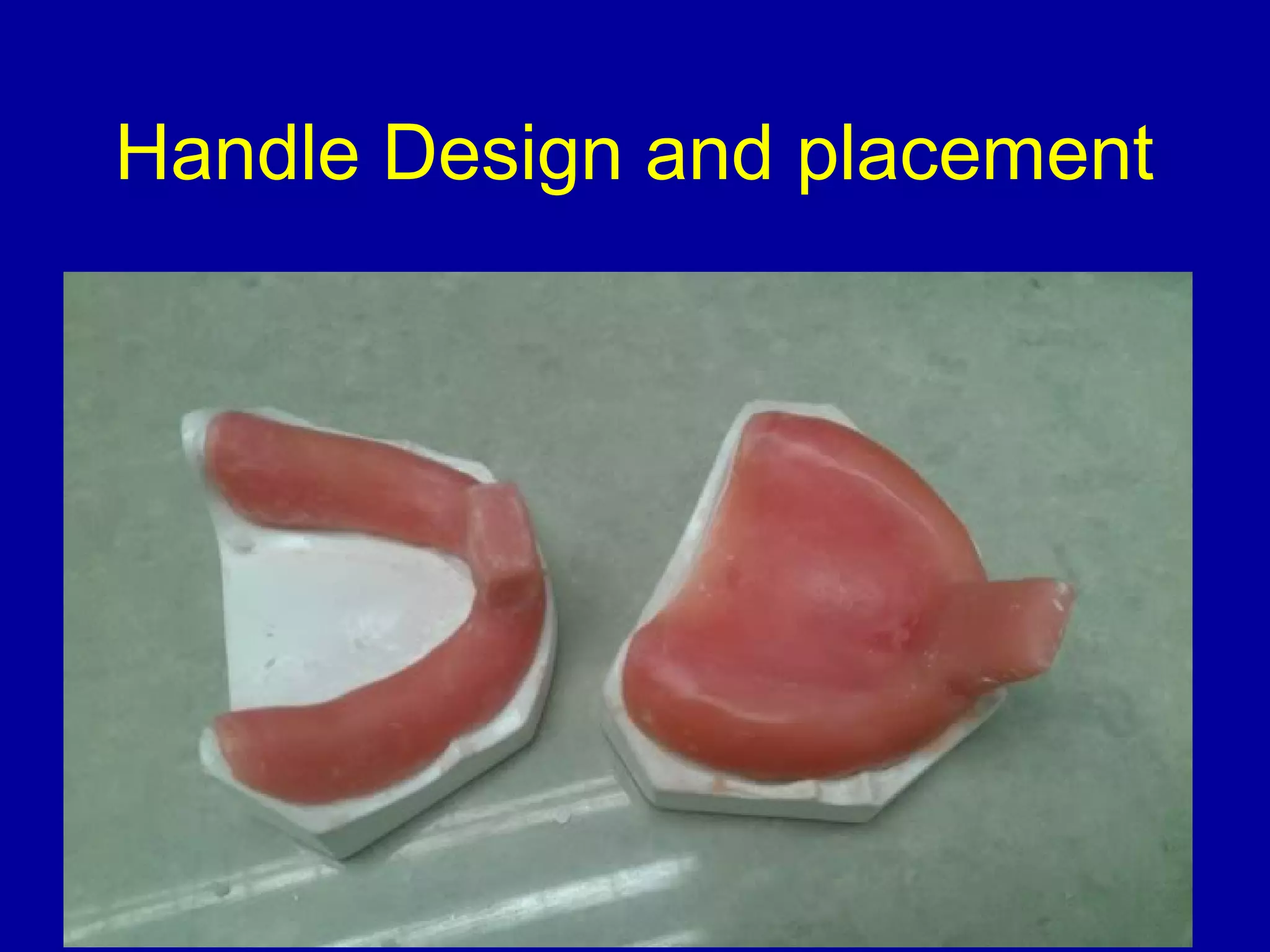 custom trays & master casts | PPT | Oral care | Personal Care