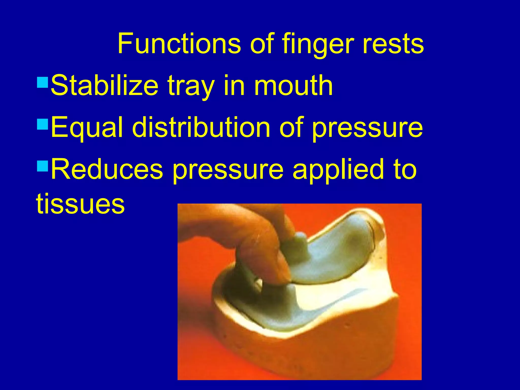 custom trays & master casts | PPT