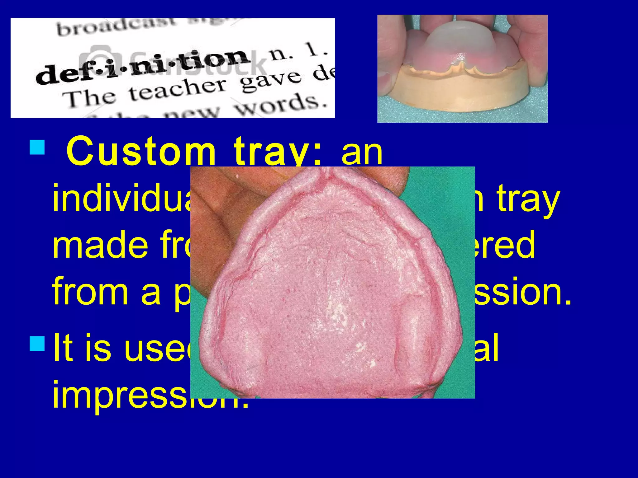 custom trays & master casts | PPT