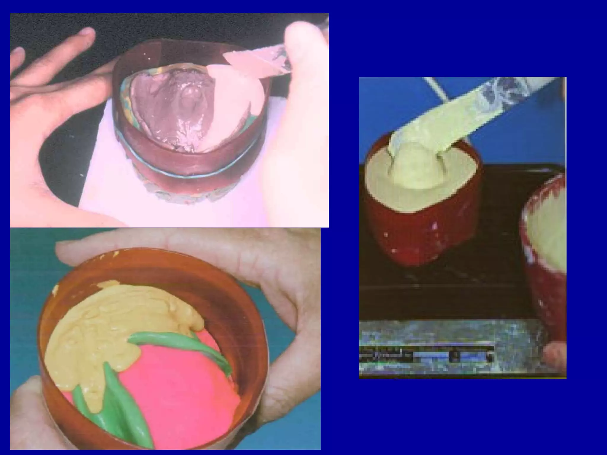 custom trays & master casts | PPT