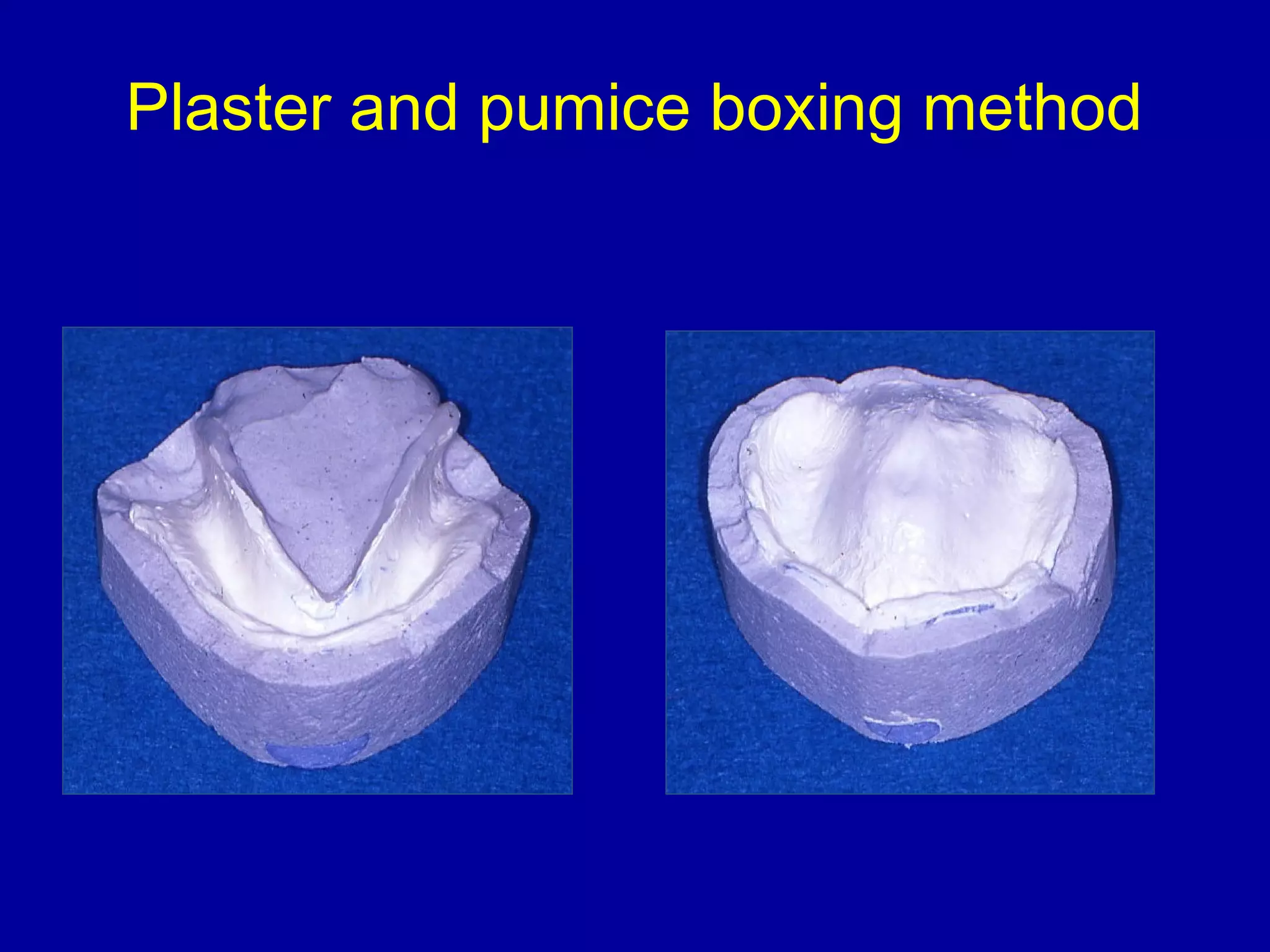custom trays & master casts | PPT