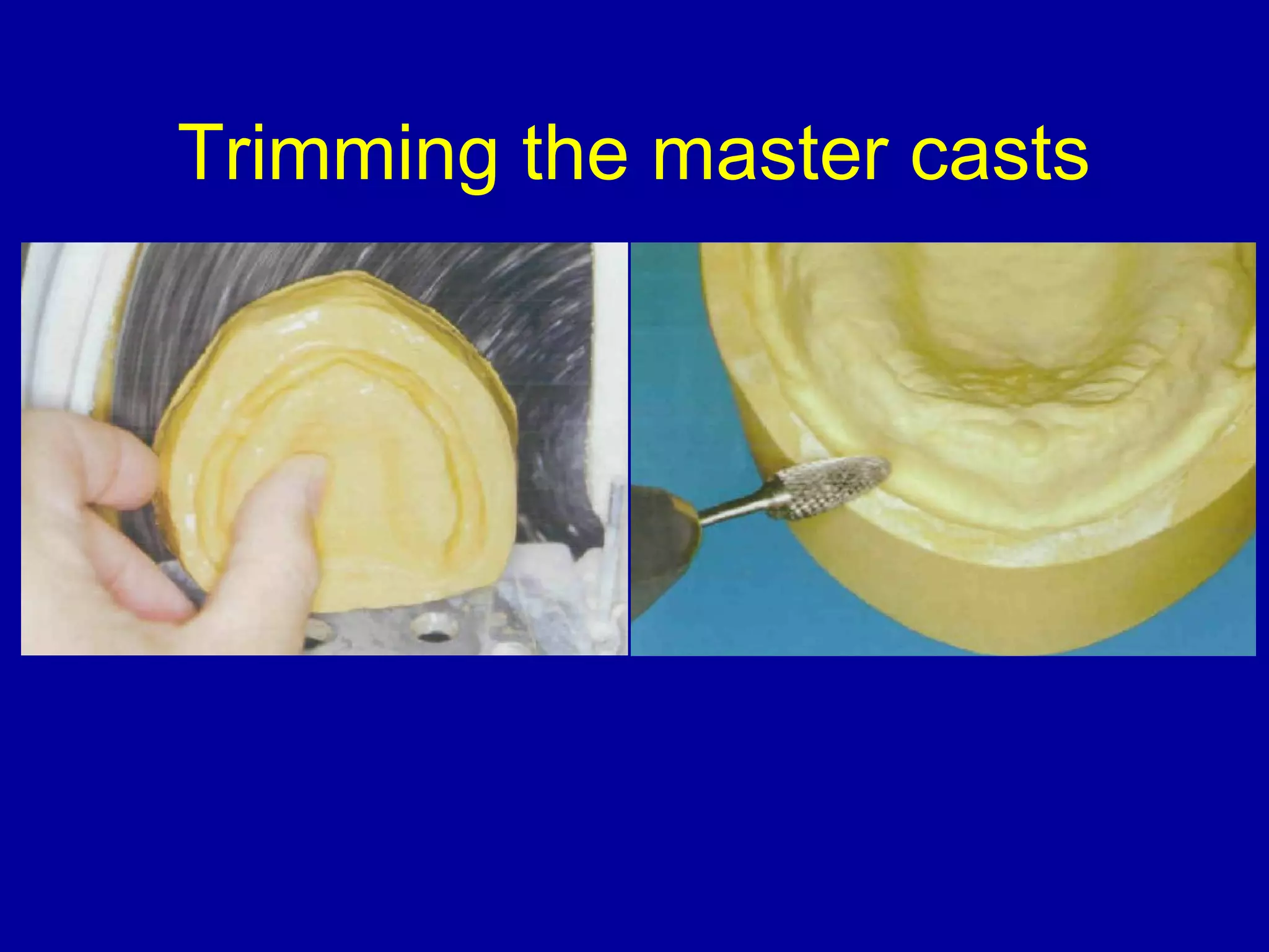 custom trays & master casts | PPT